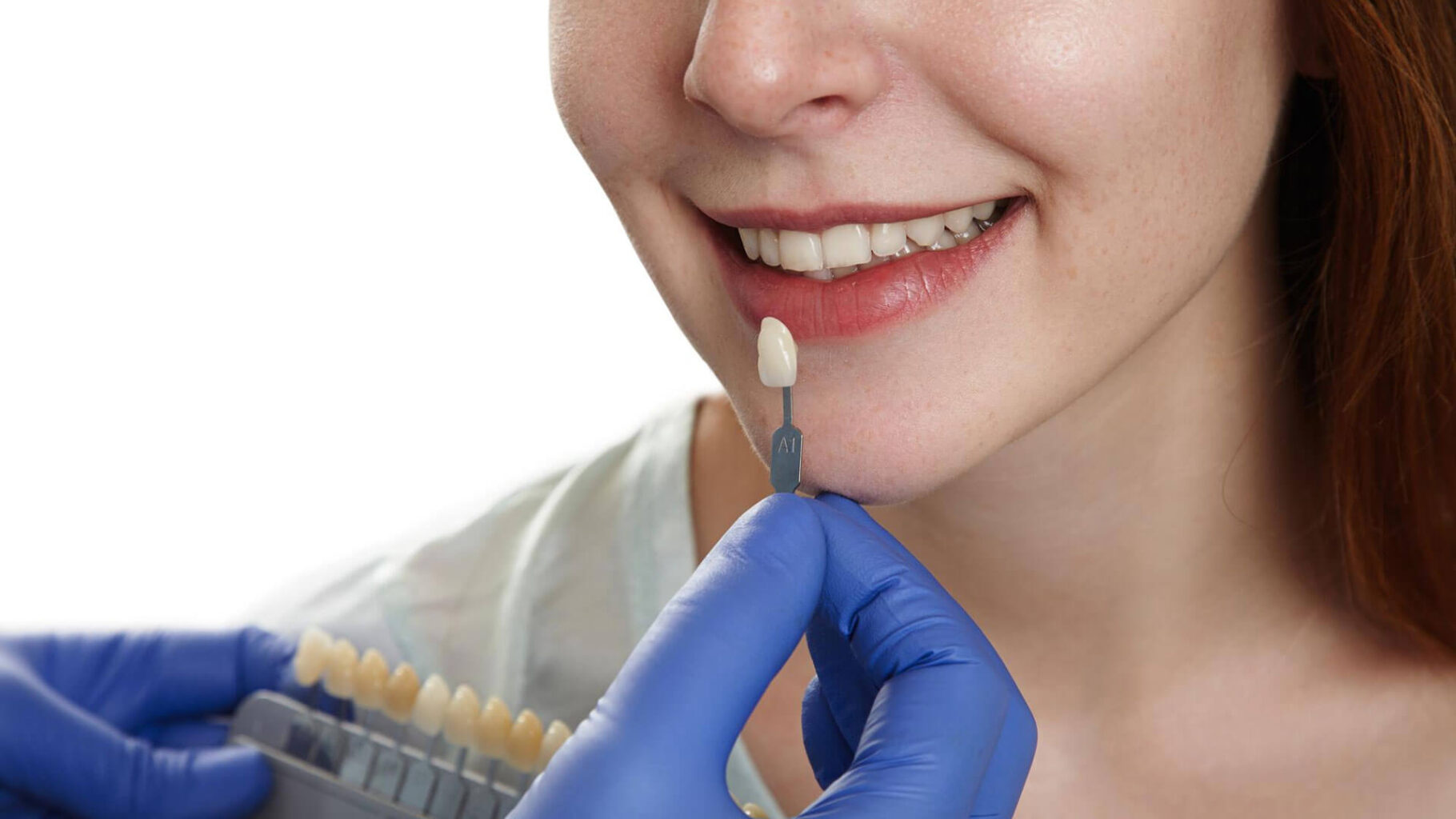 Veneer Teeth – Astai Medical & Health Tourism